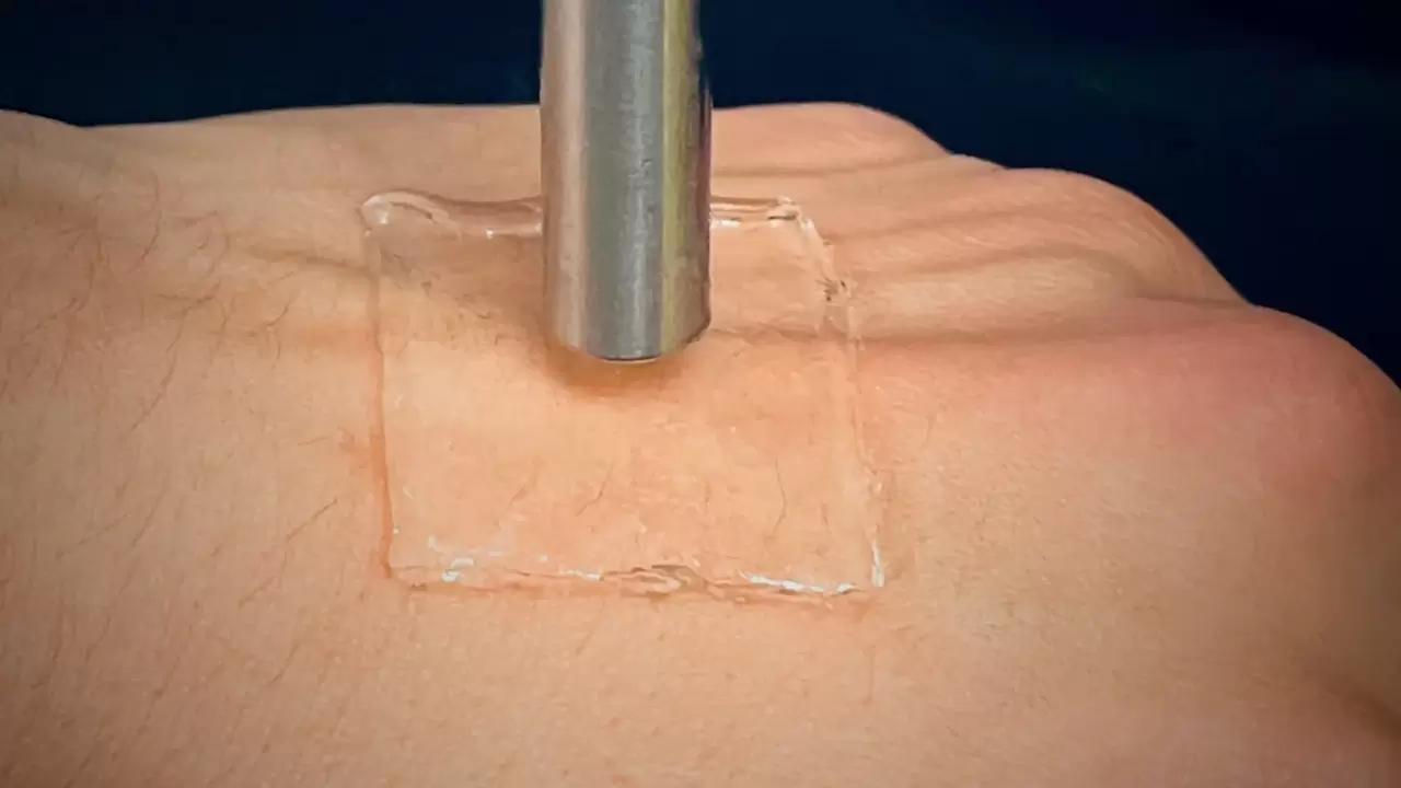 Новый гидрогелевый пластырь использует ультразвук для лучшего ...